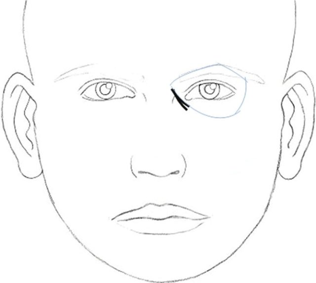 TEAR THROUGH RECOMMENDATIONS – The Indigo Clinic