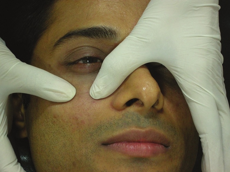 TEAR THROUGH RECOMMENDATIONS – The Indigo Clinic